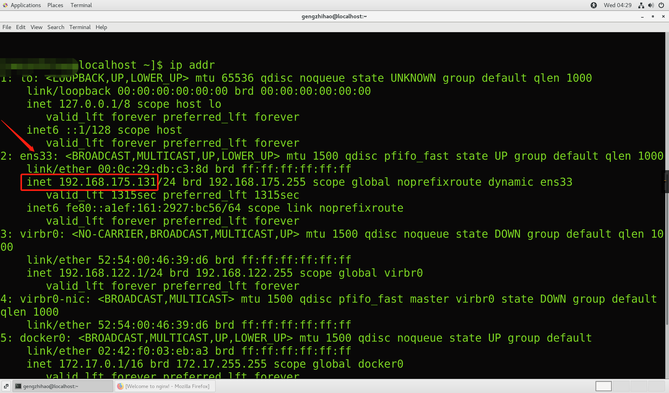 【Linux】如何查看Linux的Ip_linux 中inet后面的是什么-CSDN博客