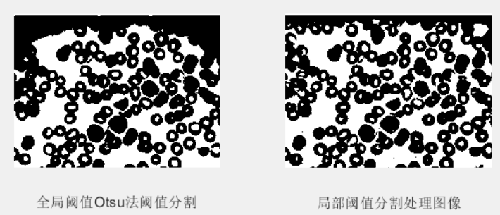 使用局部阈值方法对灰度图像进行二值化adaptthresh Csdn博客