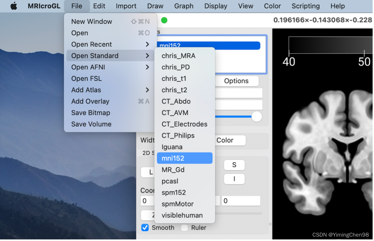 使用Matlab SPM12与MRIcroGL进行头核磁ROI的标准化与Overlap图的制作_YimingChen98的博客-CSDN博客