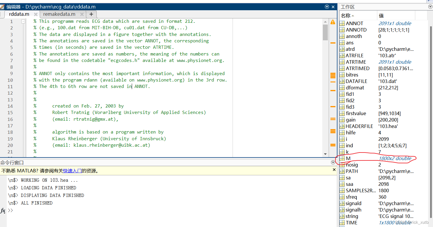 MATLAB中实现ECG数据降噪代码部分设计_添加50赫兹电源线噪声和基线漂移-CSDN博客