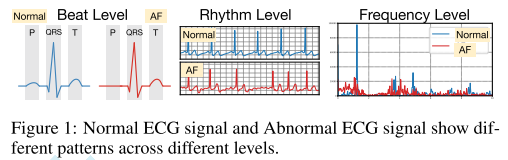 【重要】ECG attention_cinc 2017-CSDN博客
