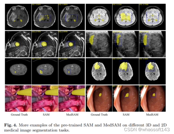 Segment Anything~医学图像领域_segment-anything 医学图像 代码-CSDN博客