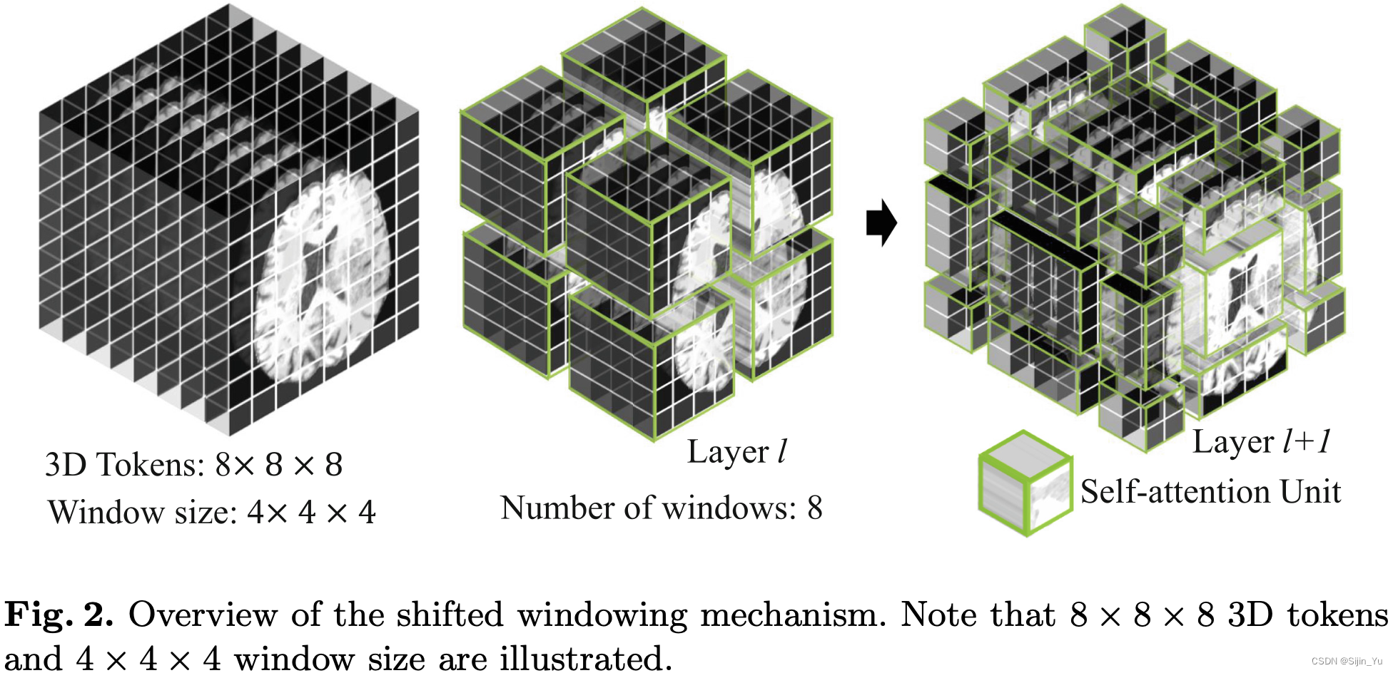 [论文笔记] Swin UNETR 论文笔记: MRI 图像脑肿瘤语义分割_swin unetr: swin transformers for ...
