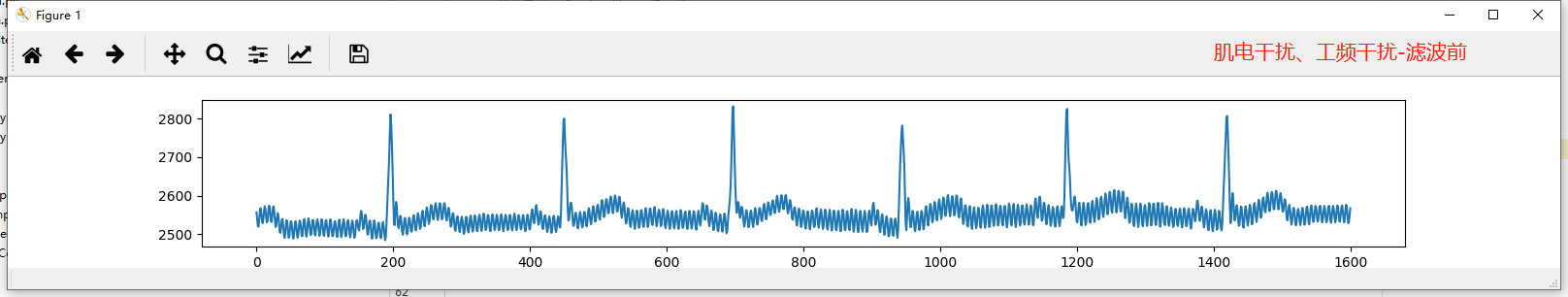 ECG信号滤波及计算心率_ecg滤波-CSDN博客