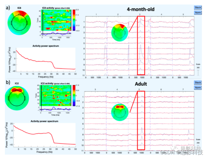 发展认知科学EEG研究: 新视角与挑战_脑电相对功率是什么,有什么意义-CSDN博客