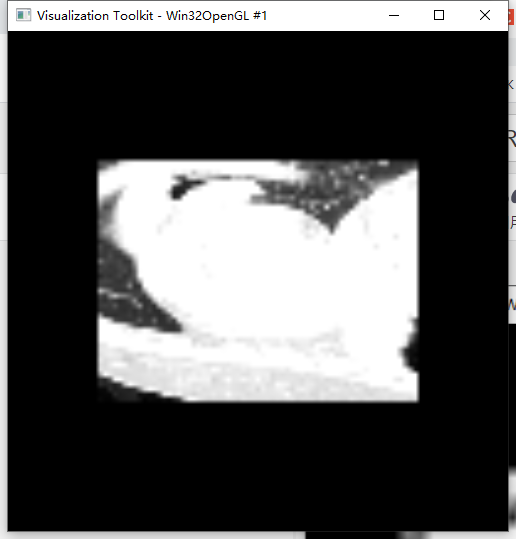 VTK笔记-计算MPR切面-vtkImageReslice输出视口设置-CSDN博客