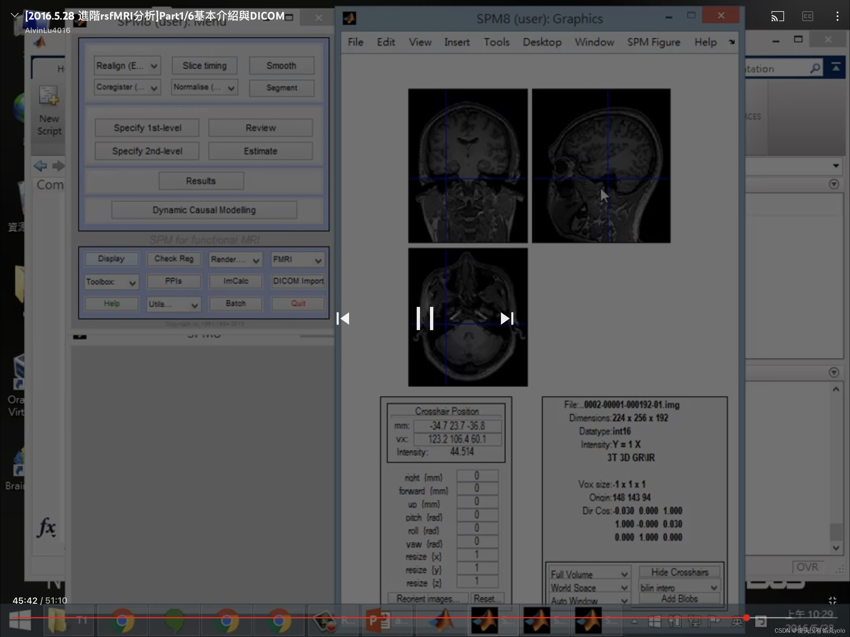 卢家峰课程系列-- advanced rs-fmri analysis 1/6 基本介绍与DICOM_ima文件如何转dicom-CSDN博客
