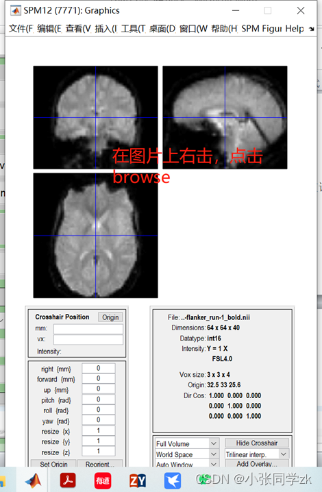 基于Spm12对fMRI数据的分析（超详细）-CSDN博客