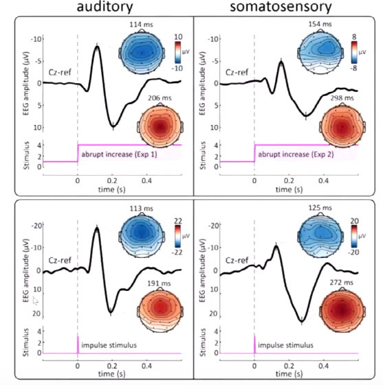 EEG脑电数据预处理_eeg预处理-CSDN博客