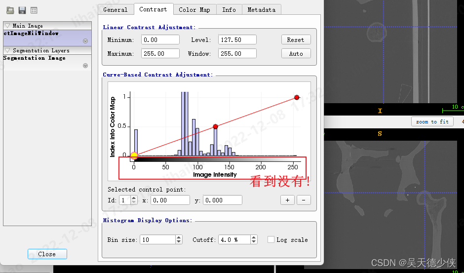 使用itk进行窗宽窗位的设置_itksnap调窗宽窗位-CSDN博客