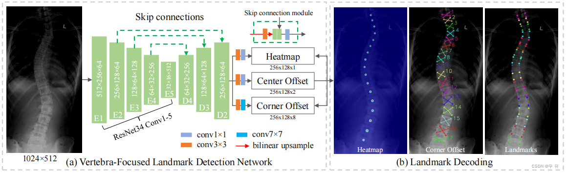 【论文|复现]Vertebra-Focused Landmark Detection For Scoliosis Assessment-CSDN博客