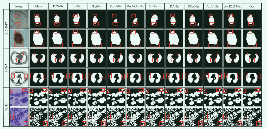 ResGANet: Residual group attention network for medical image ...