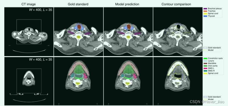 Clinically applicable deep learning framework for organs at risk delineation in CT images-CSDN博客