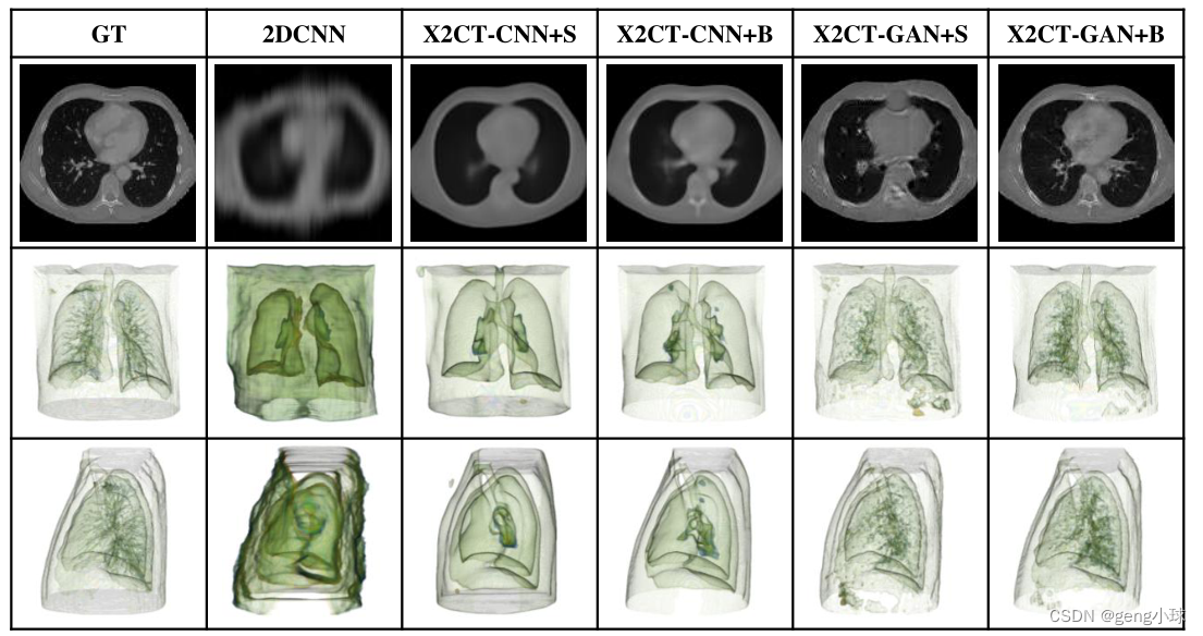 论文翻译：X2CT-GAN: Reconstructing CT from Biplanar X-Rays with Generative Adversarial Networks-CSDN博客