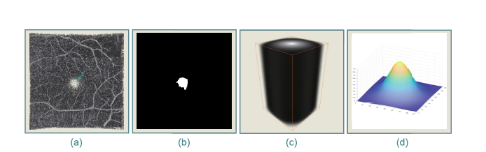 Image Projection Network: 3D to 2D ImageSegmentation in OCTA Images 论文 ...