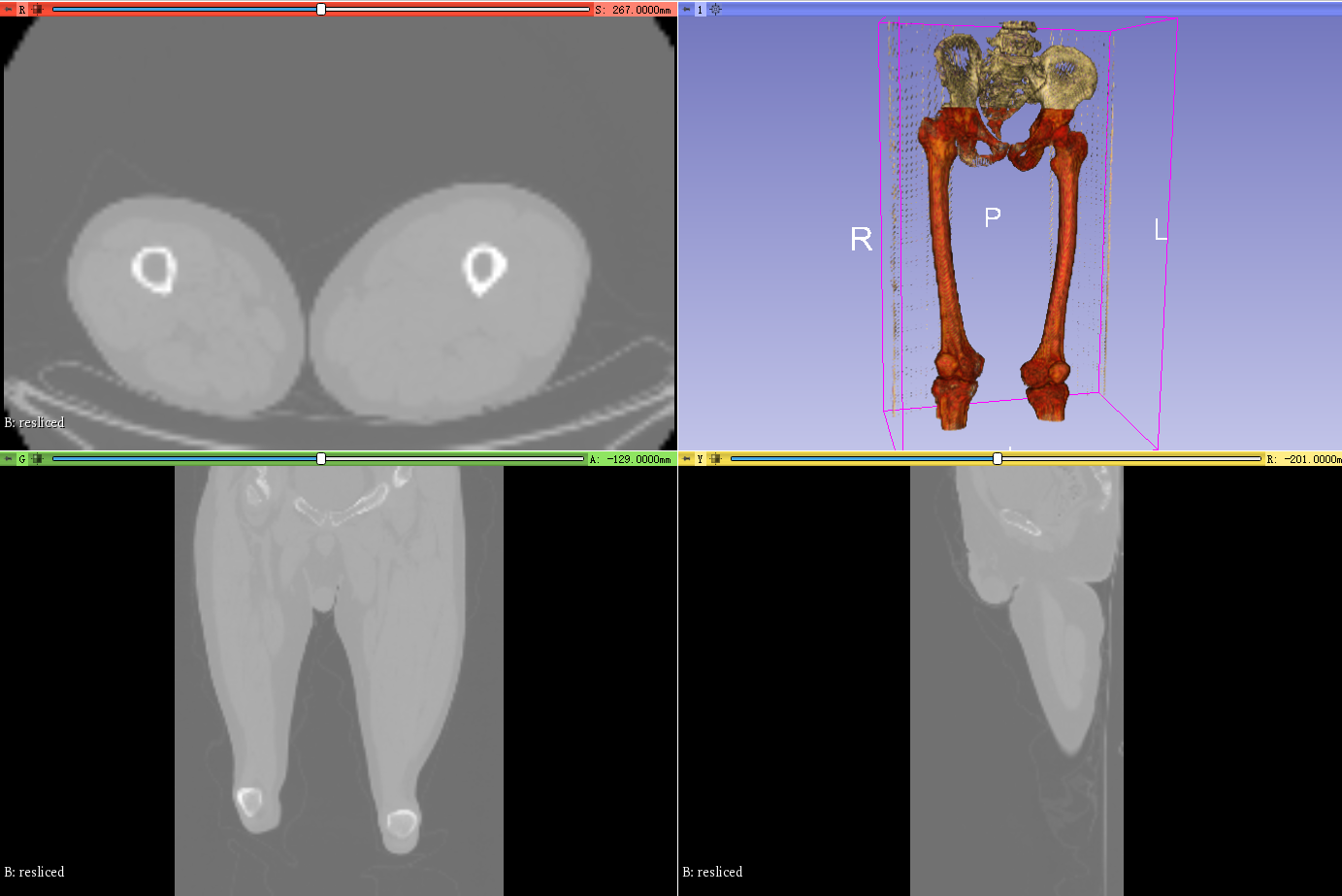 VTK学习笔记（十六）vtkImageReslice 与 vtkExtractVOI_vtkcommand::leftbuttonpressevent-CSDN博客