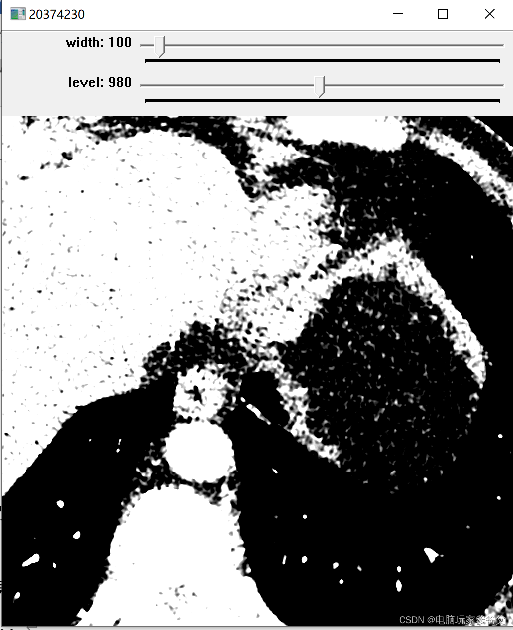 Opencv 实验:实现窗宽窗位调节(附源码及解析)医学影像切片显示与窗宽窗位调节 实验目的 掌握图像矩阵的像素访问方 Csdn博客