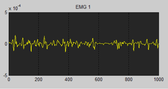 sEMG分析-CSDN博客