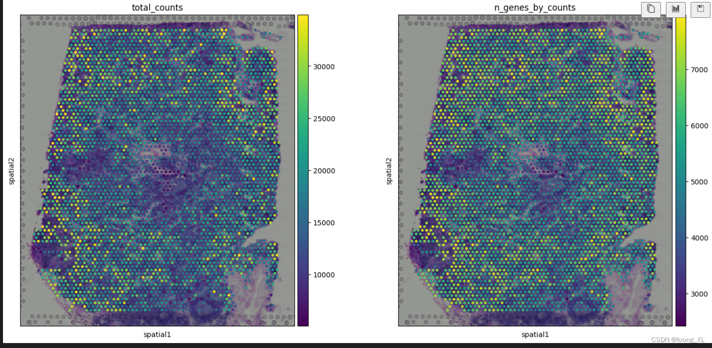 单细胞空间组学 scanpy代码案例_loong_XL的博客-CSDN博客