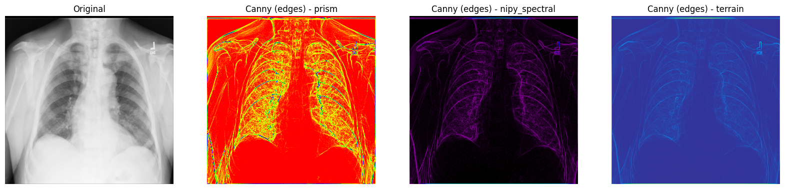 NumPy 应用：X射线图像处理_射线扫描里面的grayscale plot-CSDN博客