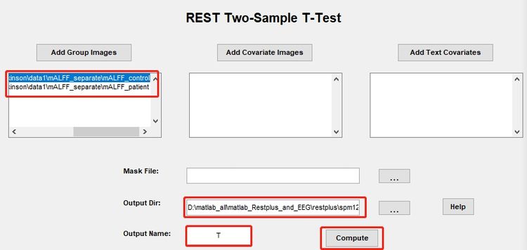 matlab wsd,matlab-restplus&gretna—MRI_史雨寒的博客-CSDN博客