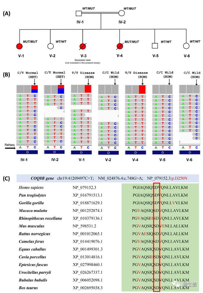 文献 | 全外显子组显示COQ8B基因纯合突变与肾病综合征有关 (IF: 4.4)-CSDN博客