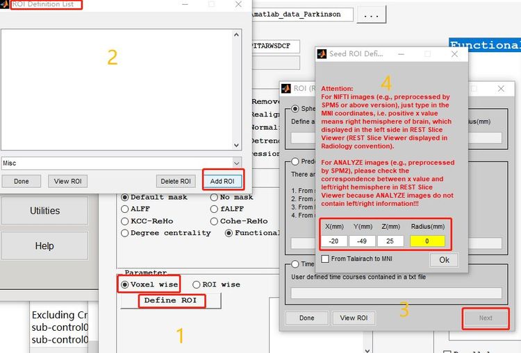 matlab wsd,matlab-restplus&gretna—MRI_史雨寒的博客-CSDN博客