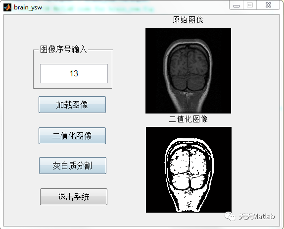 【图像分割】基于计算机视觉实现医学影像分割含gui界面视觉软件界面和算法分开 Csdn博客 6521