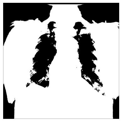 NumPy 应用：X射线图像处理_射线扫描里面的grayscale plot-CSDN博客