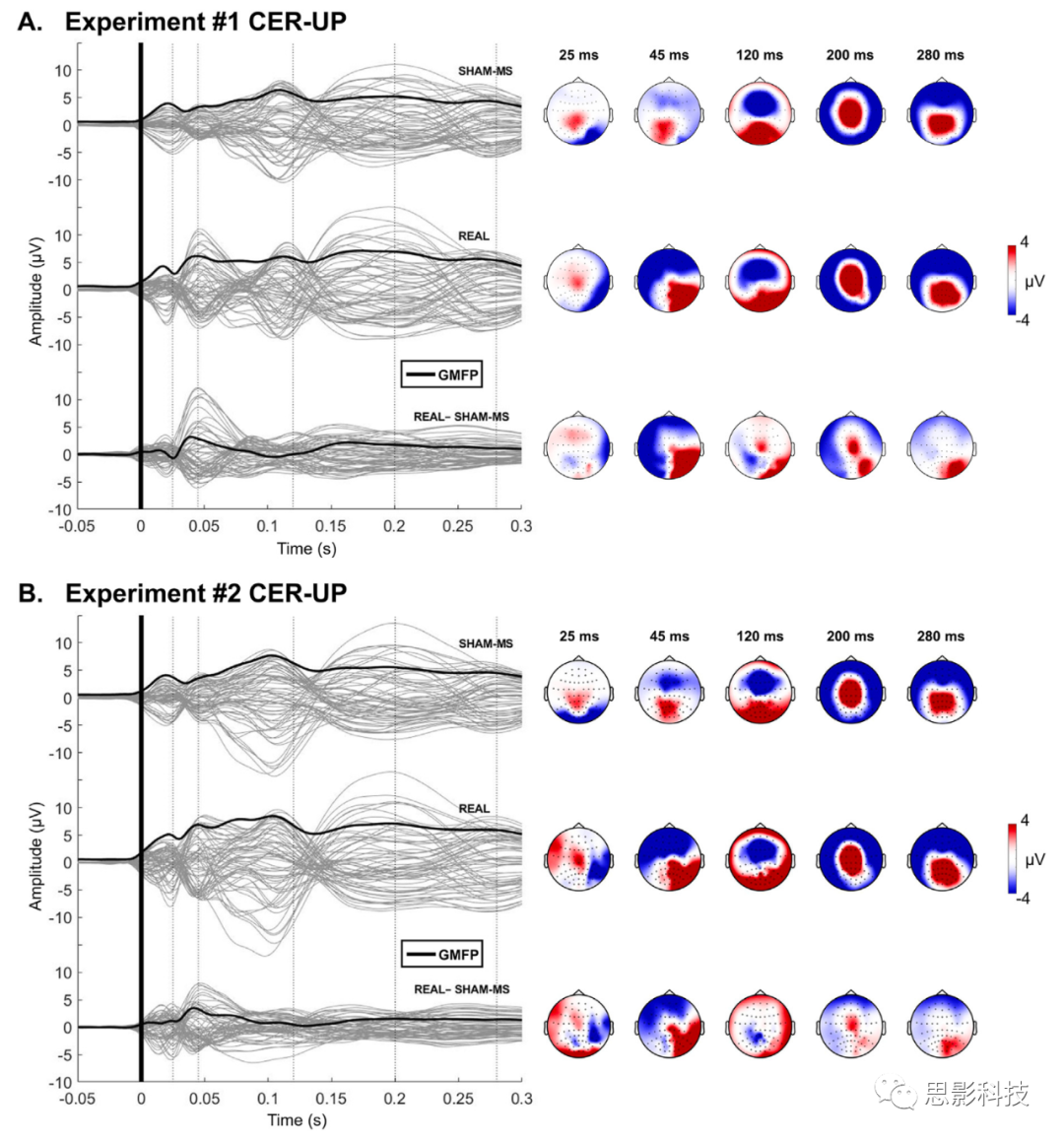使用TMS-EEG评估小脑与大脑皮层的有效连接性_基于簇的排列测试-CSDN博客