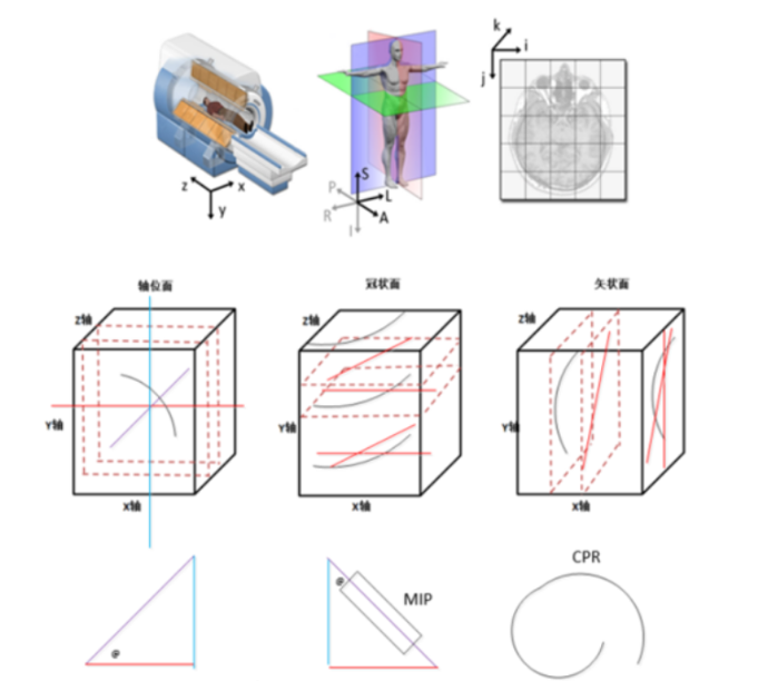 dicom 多平面重建 MPR CPR 斜位 曲线 原生代码算法原理_cpr和mpr-CSDN博客