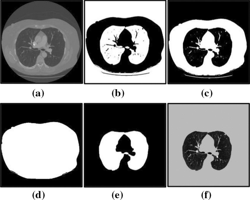 python包NiBabel对医学影像文件格式进行读写并可视化实战:查看和显示.nii.gz、.nii文件_如何可视化nii.gz-CSDN博客