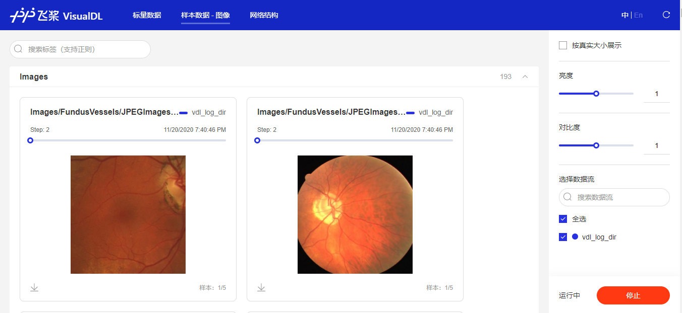 使用VisualDL可视化基于PaddleSeg的眼底血管分割_眼底图像中的cup和rim可视化-CSDN博客