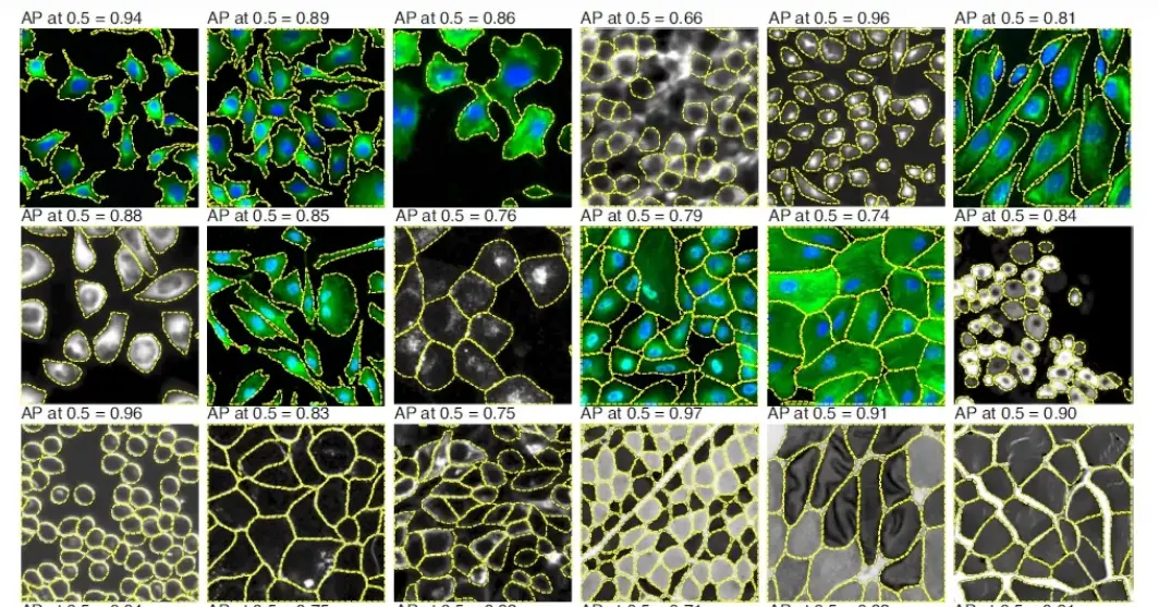 ISS空间转录组的细胞分割算法汇总(stardist、cellpose、QuPath、SCS)_空间组学-iss-CSDN博客