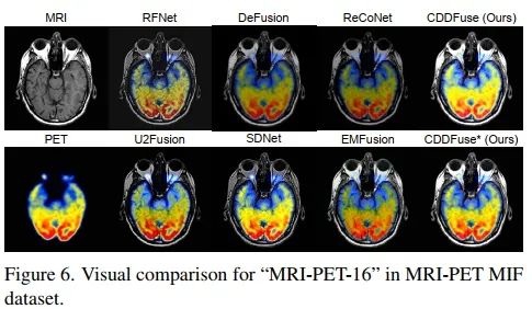 CVPR'23 | 结合Transformer和CNN的多任务多模态图像融合方法-CSDN博客