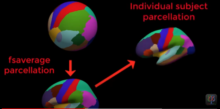 freesurfer全过程梳理-CSDN博客