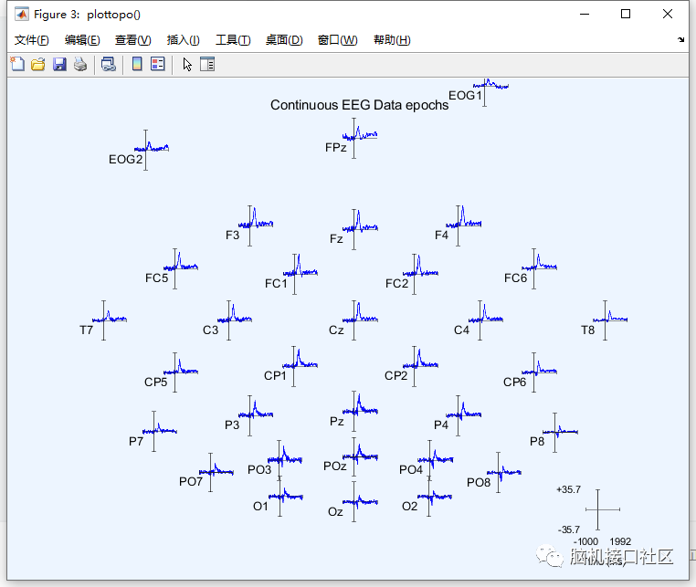 eeglab教程系列(7)-数据叠加平均{1}(Data averaging)-CSDN博客