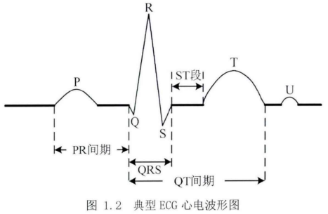 MIT-BIH介绍（一）为什么要使用MIT-BIH？_mit-bih心电数据库-CSDN博客