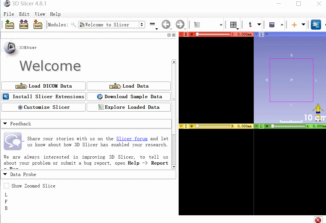 3d slicer读取html图像,利用3DSlicer对JPG、BMP、TIF等格式图像三维重建-CSDN博客