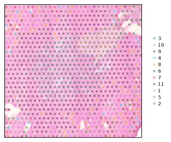 10X空间转录组Visium && HD && Xenium分析全更新_10x visium和hd的区别-CSDN博客