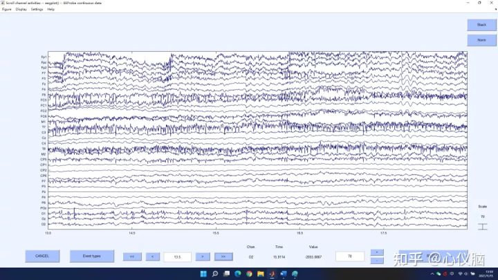无需代码，图文并茂详解EEGLAB中的ERPs数据分析方法_eeglab平均erp求和_psybrain的博客-CSDN博客