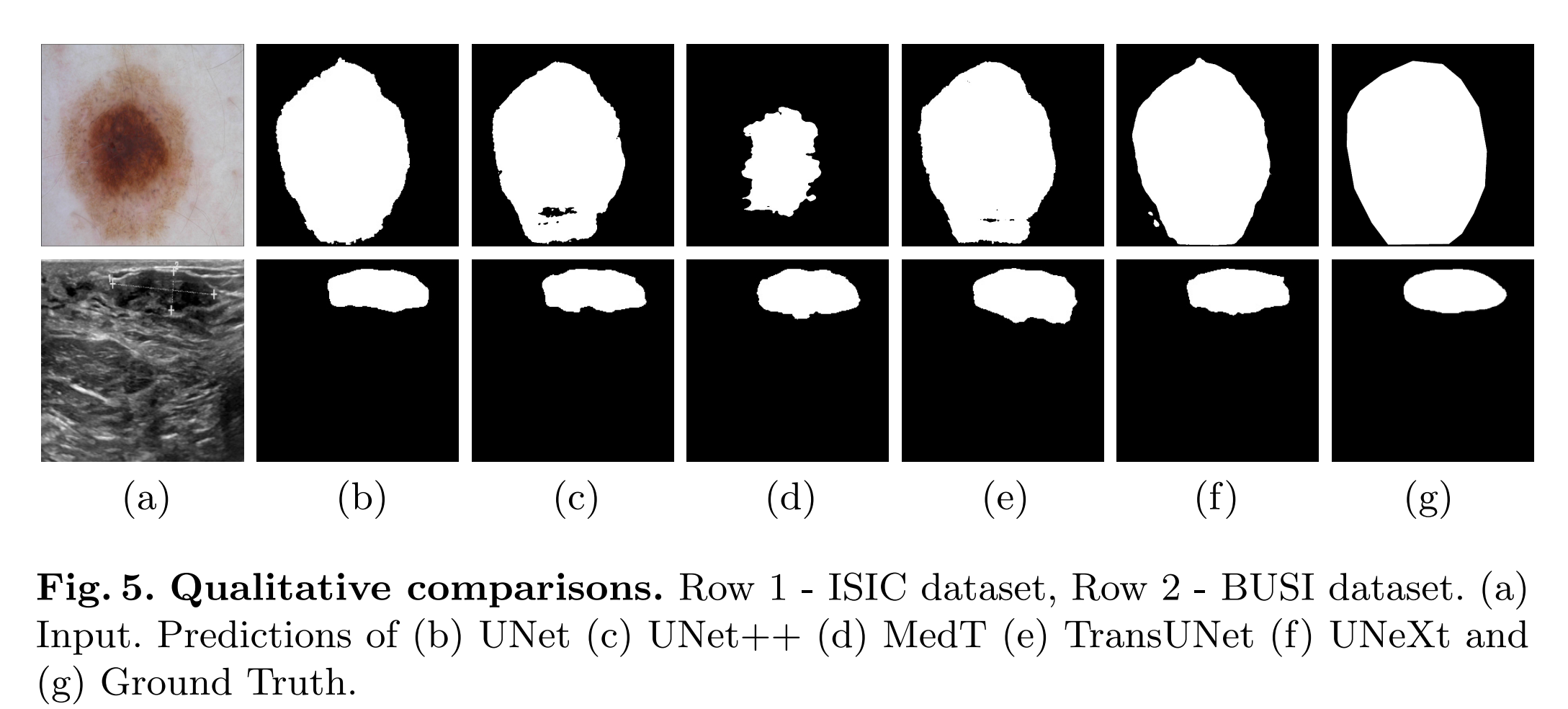 UNeXT_unext-s-CSDN博客