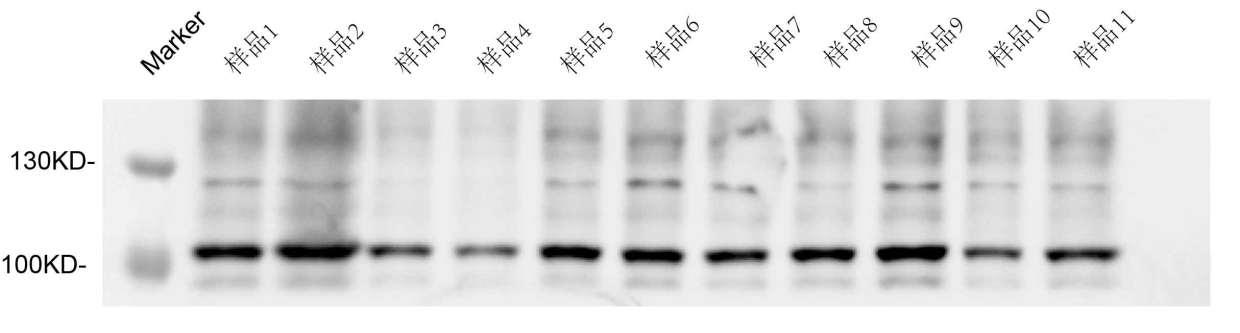 蛋白质印迹法图像结果分析WB检测技术_保存wb结果图片的时候,需要单独保存maker吗-CSDN博客