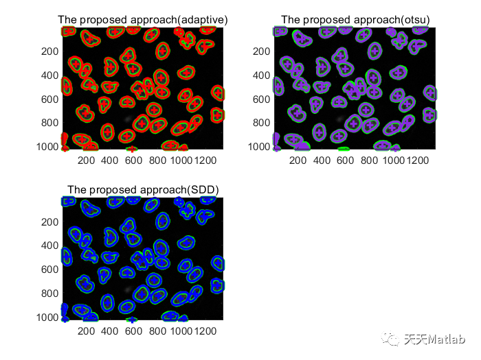 基于SDD、Otsu 和自适应阈值的U2OS 细胞图像分割算法研究对比附matlab代码-CSDN博客