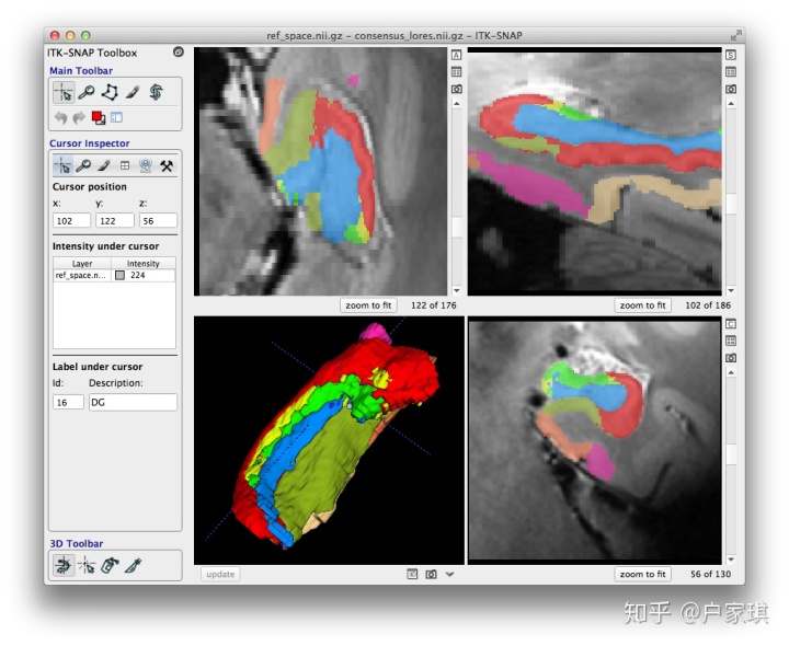 dicom标注工具_四款常用的医学图像标注工具-CSDN博客