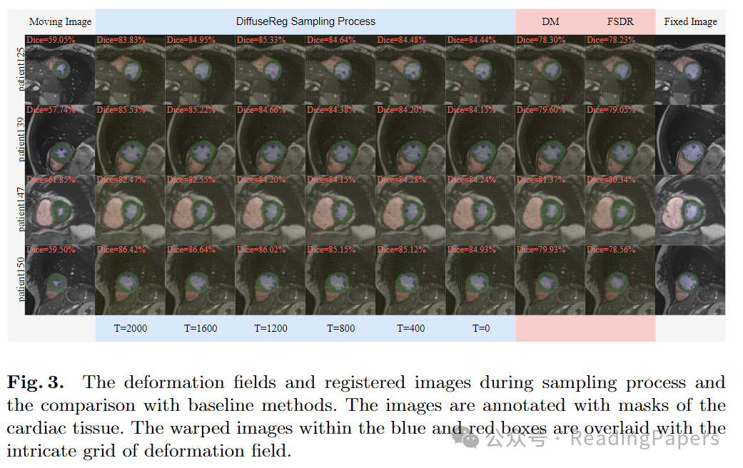医图顶会 MICCAI‘24 | DiffuseReg: 无监督可变形图像配准中获取形变场的去噪扩散模型-CSDN博客