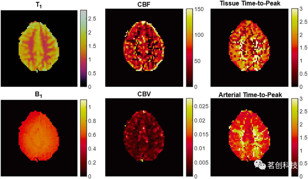 J Magn Reson Imaging：磁共振指纹(MRF)动脉自旋标记(ASL)的灌注特性估计_asl参数的间隔时间-CSDN博客
