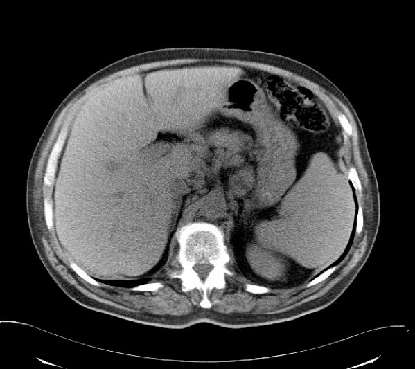CT一般扫描参数_CT图像质量参数_weixin_39640883的博客-CSDN博客