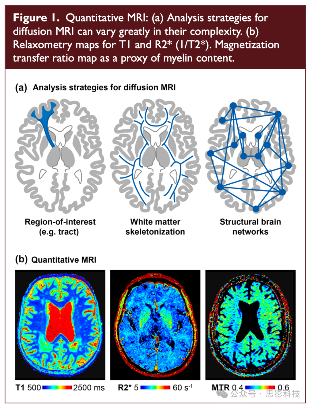 脑小血管病高级MRI成像-CSDN博客