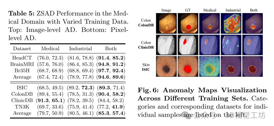 ECCV'24开源 | 零样本！全方面SOTA！AdaCLIP：CLIP杀入异常检测！-CSDN博客